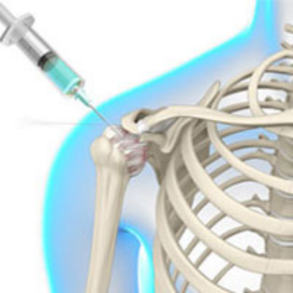 Shoulder Hydrodilatation - Ultrasound - Acorn Private Clinic - South ...