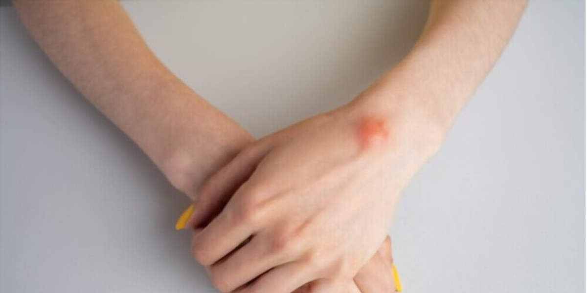 CAN ULTRASOUND TELL YOU THE DIFFERENCE BETWEEN LIPOMA AND LIPOSARCOMA?